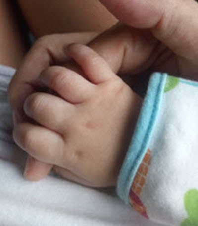 Liability For Common Birth Defects